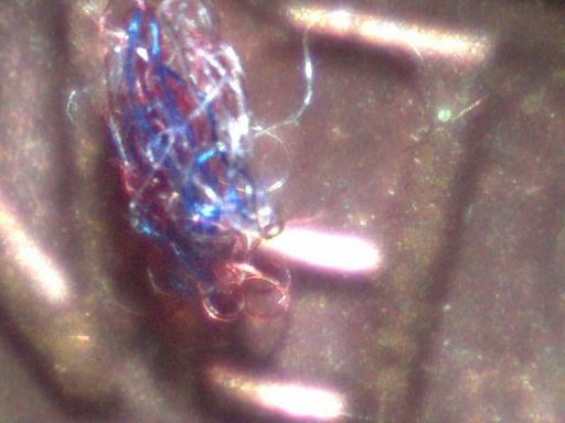 The Telegraph: Morgellons Disease continues to defeat scientists | Metabunk